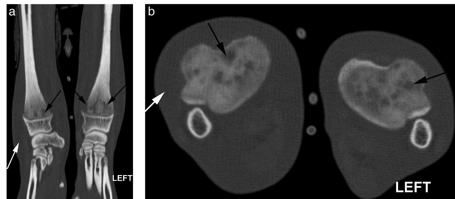 Dorsal (a) and transverse (b) plane reconstruction showing