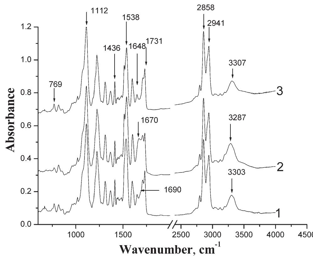 Ftir spectra of the pus: (1) g1/2, (2) g2/1, and (3) g20/1.