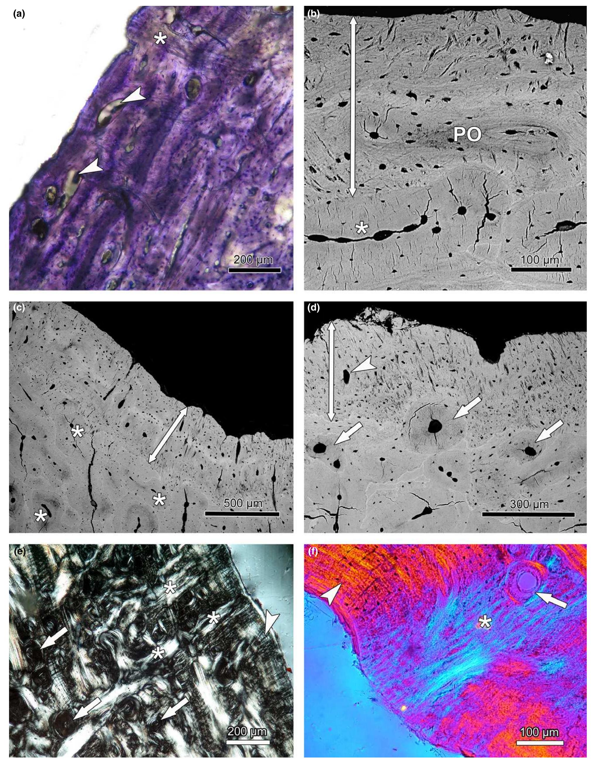 Figure 4 - The structure of pedicle and hard antler bone in