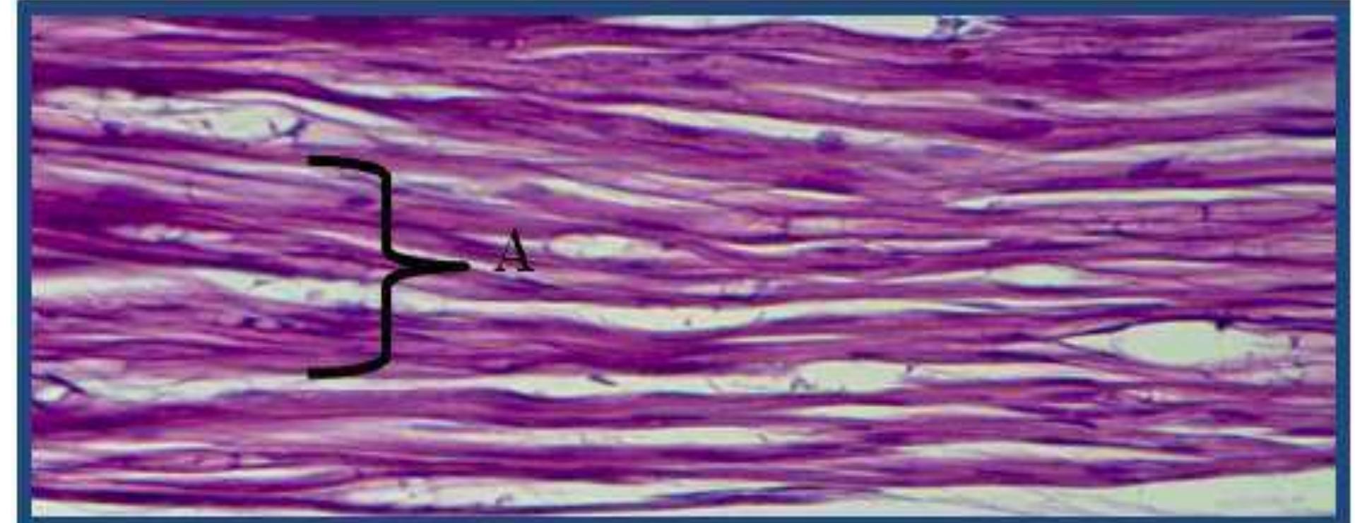 12 The Distal Longitudinal Section Of Sciatic Nerve Of