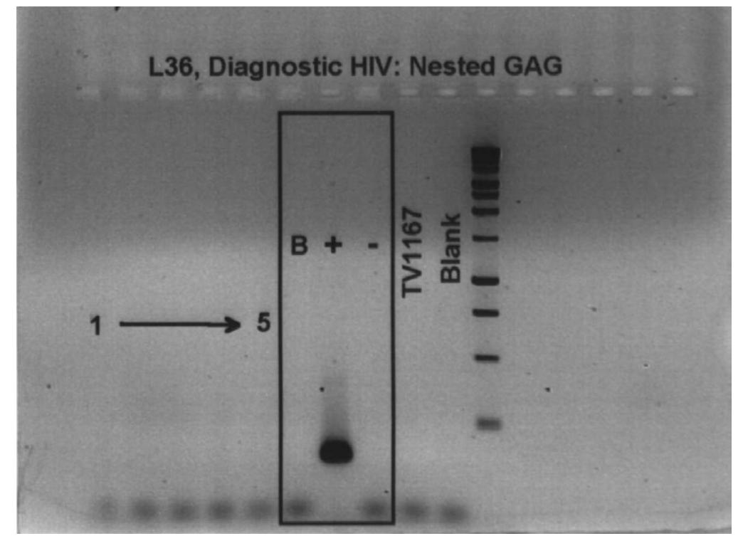 Agarose gel electrophoresis, showing five samples (1 — 5),