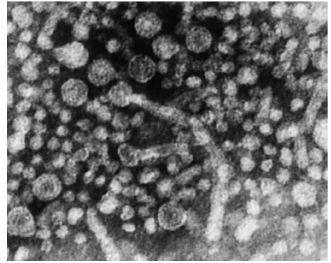 Hbv electron micrograph showing spherical dane particles
