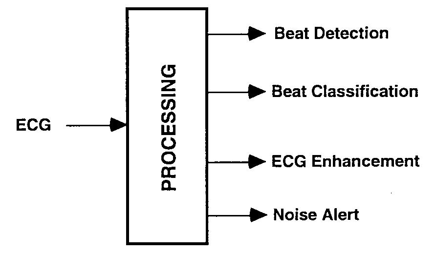 Multiple processing tasks are performed on the ecg. an