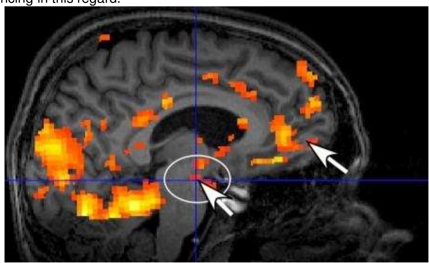 (PDF) A Cultural Perspective on Romantic Love