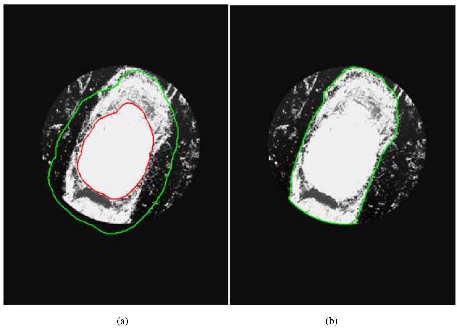 (a) segmented fpi is shown in red and the initialization is