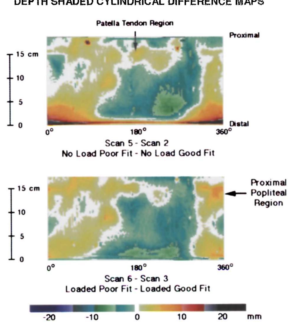 Figure 10 - Below-knee residual limb shape change