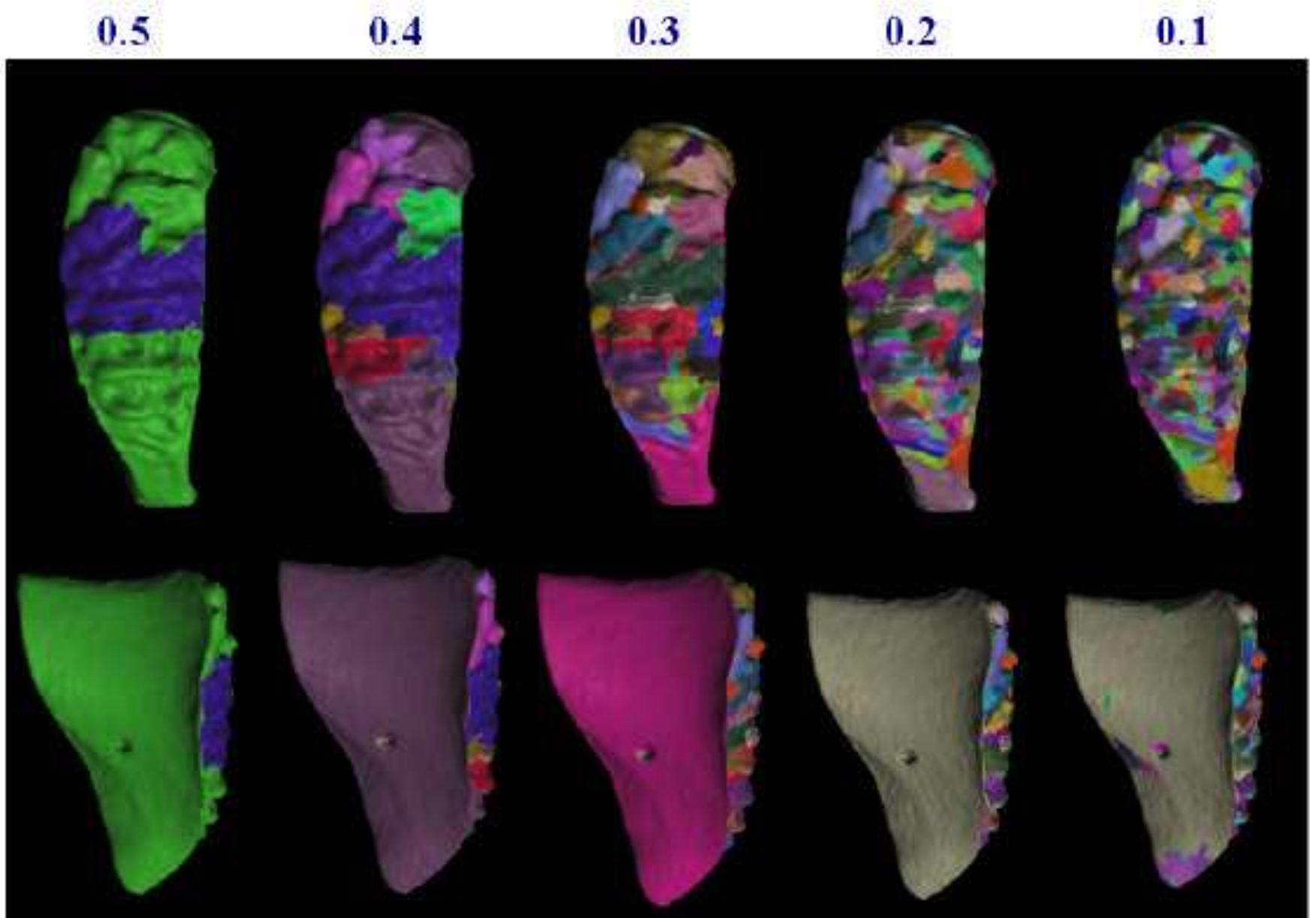 Illustration of a modeled pubic symphysis (male phase 1a)