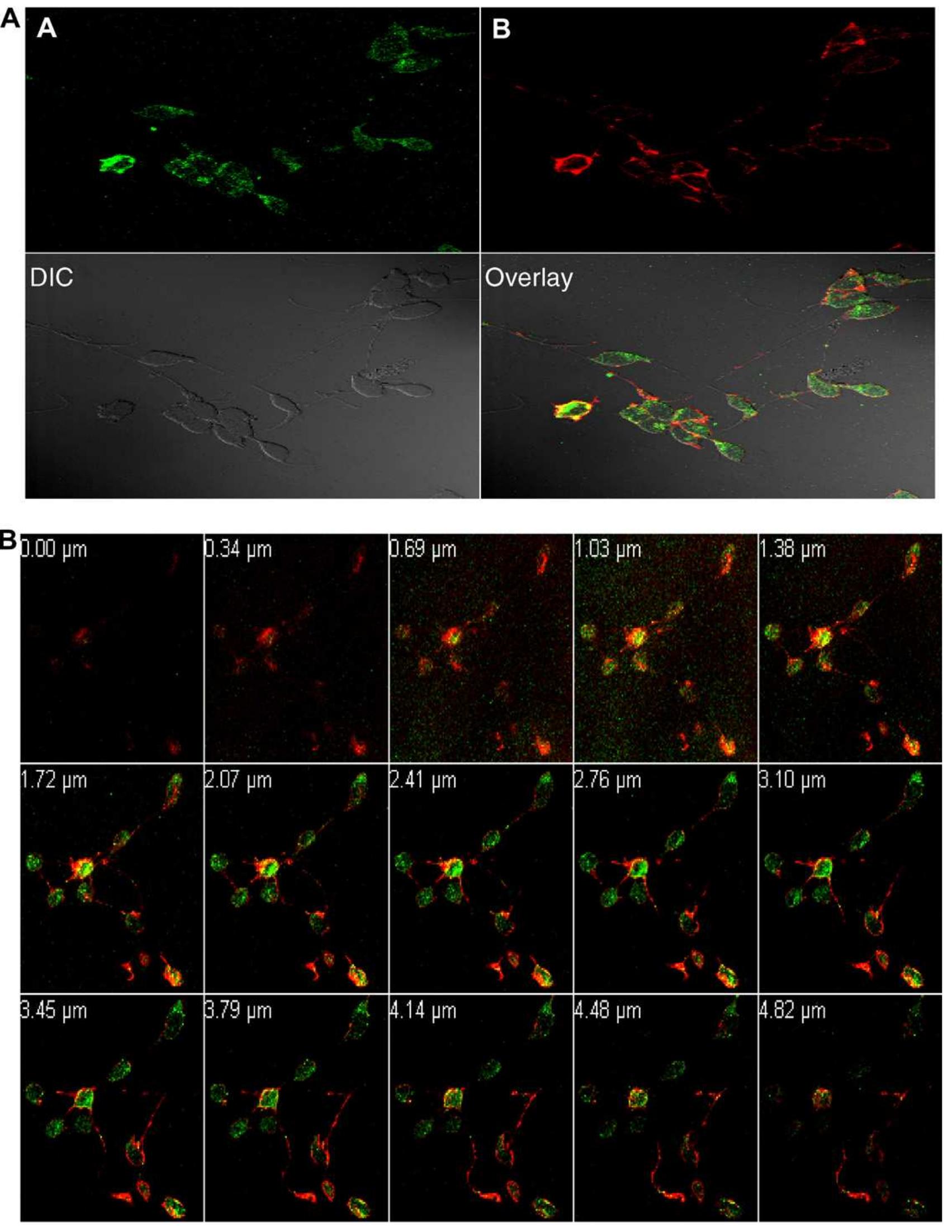 Incubation of sh-sy5y cells in presence of alexa-fluor 488