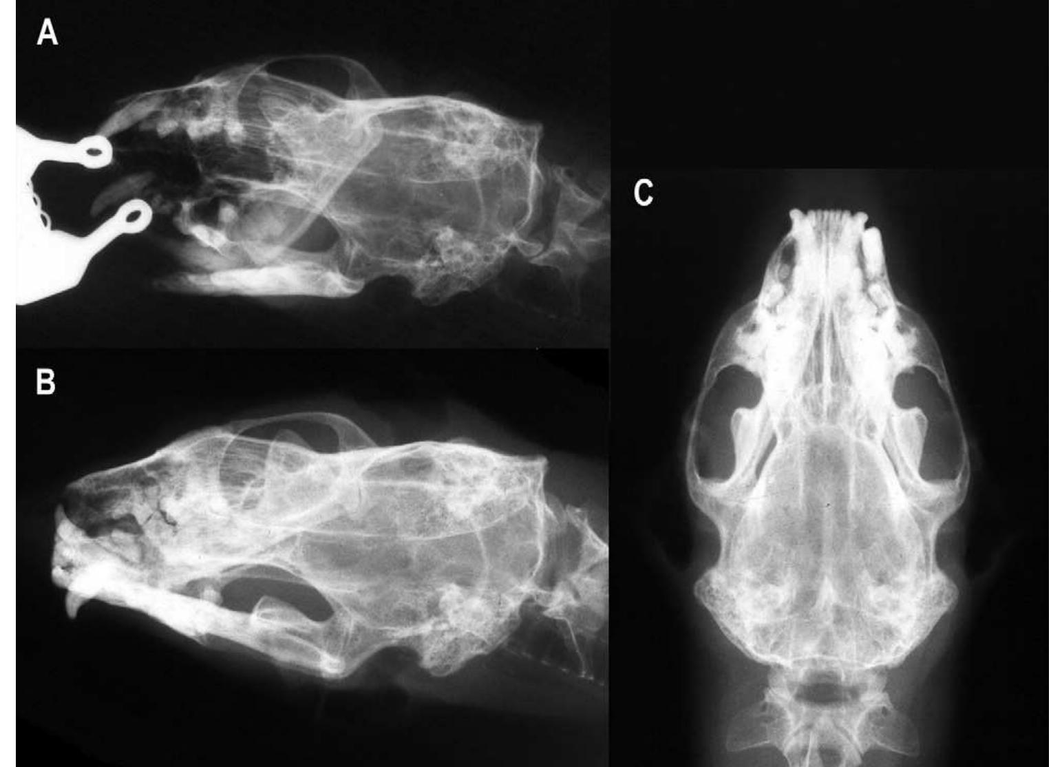 Periapical infection of the left maxillary canine tooth. (a)