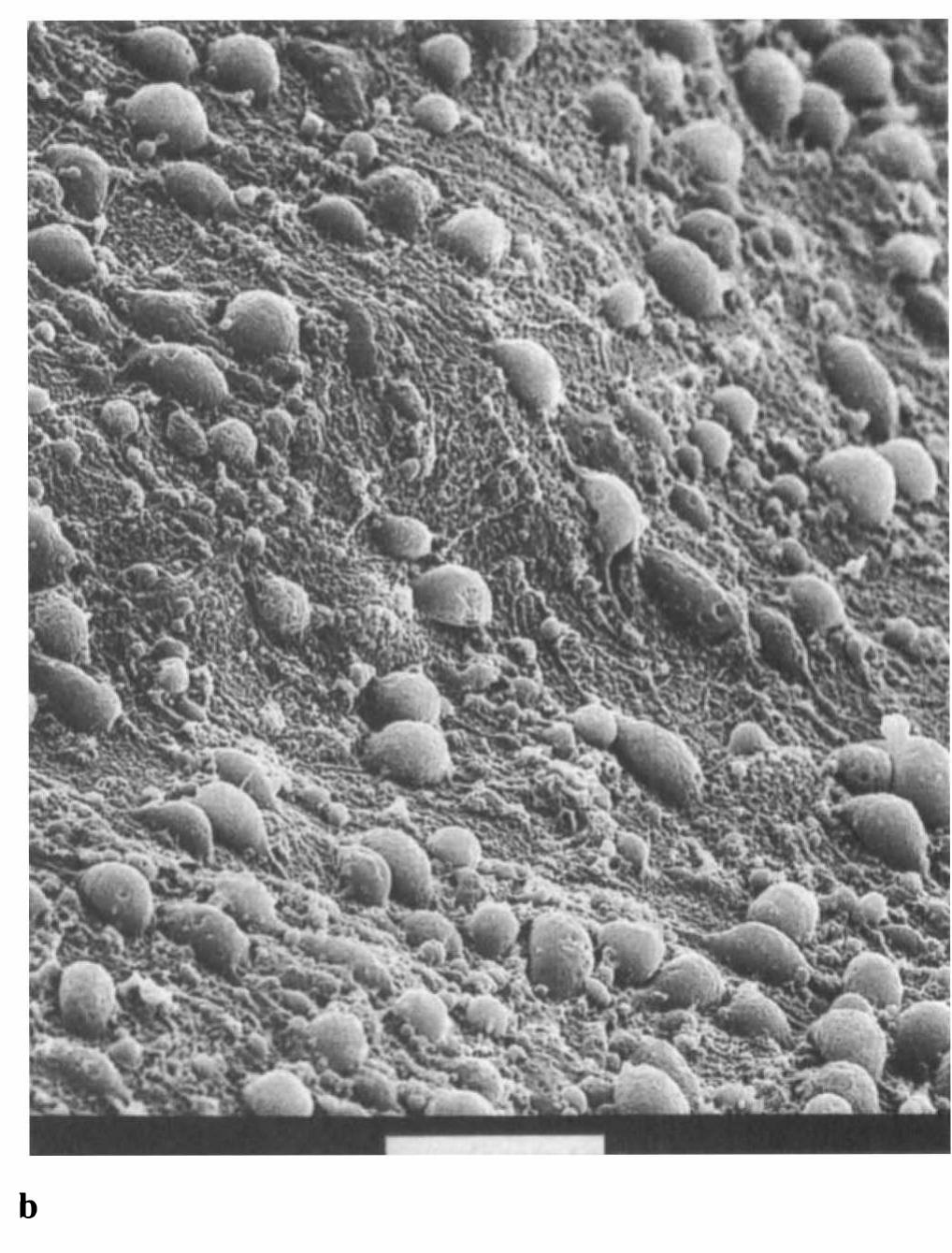 Figure 9 - Anatomy and pathology of the vitreo-retinal