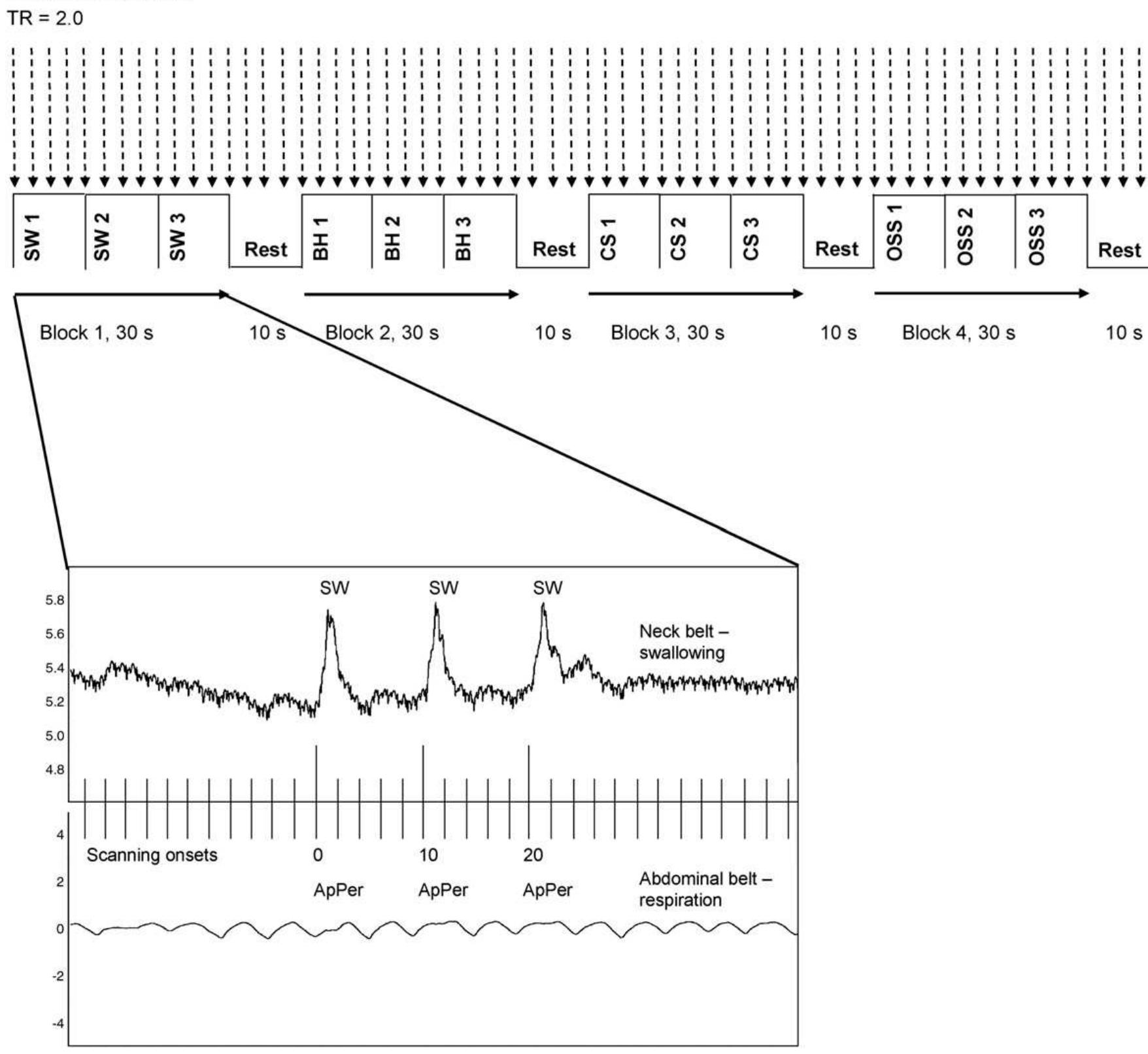 Schematic of the {mri design. each block contained three
