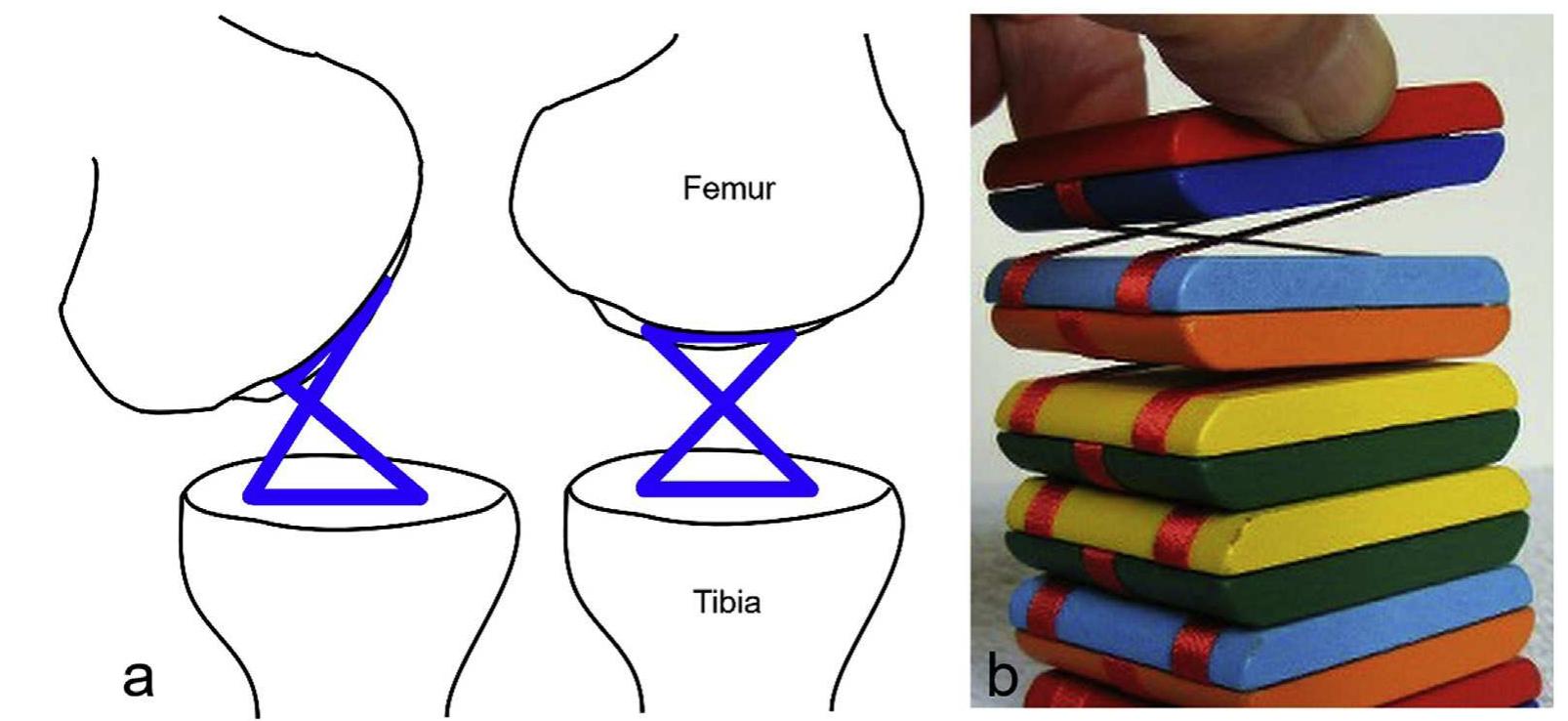 A) ligaments within the ckc system. a stylized diagram of