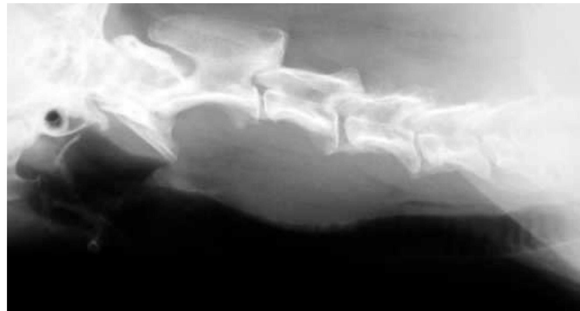 Lateral radiograph of the cervical area in a skeletally