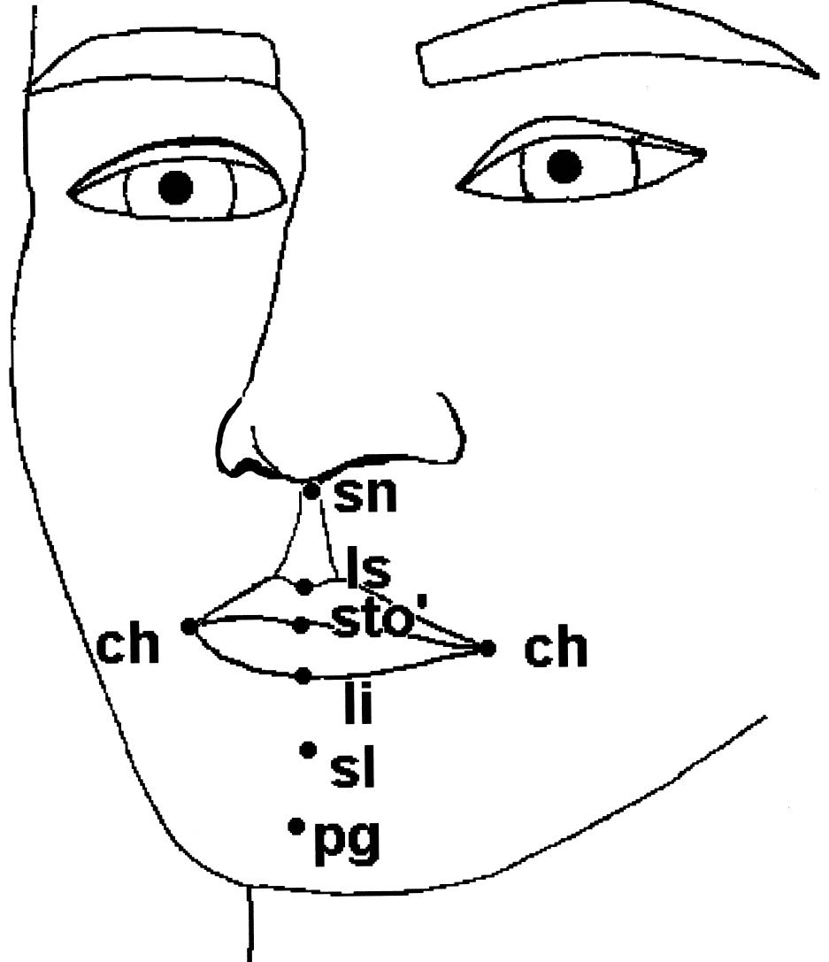 Digitised soft-tissue 3-d landmarks: sn, subnasale; is,