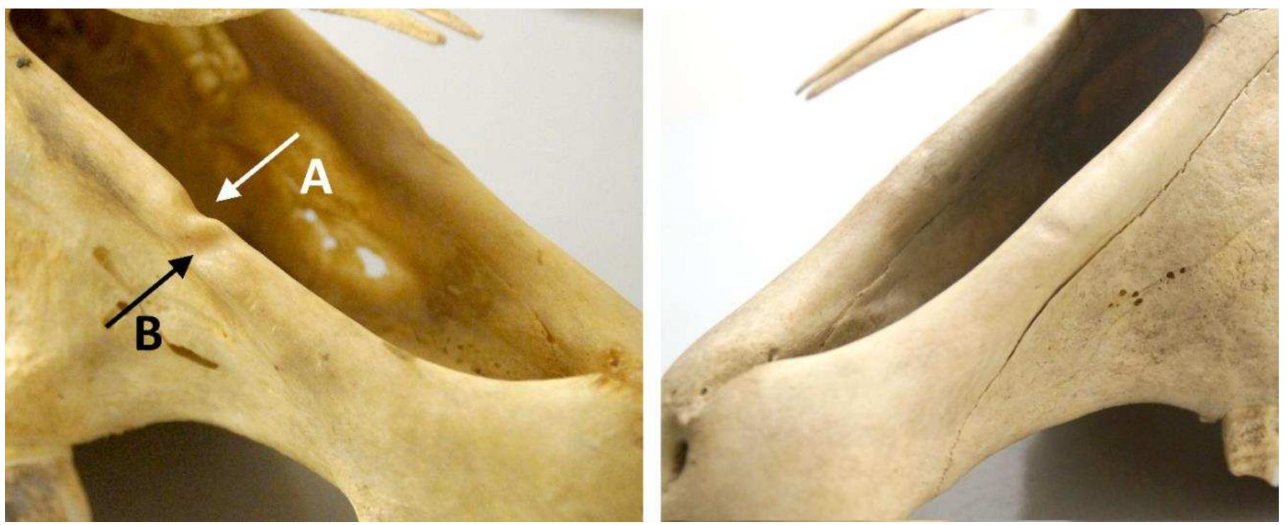 3 medial (a) and lateral (b) groove formation on the nasal