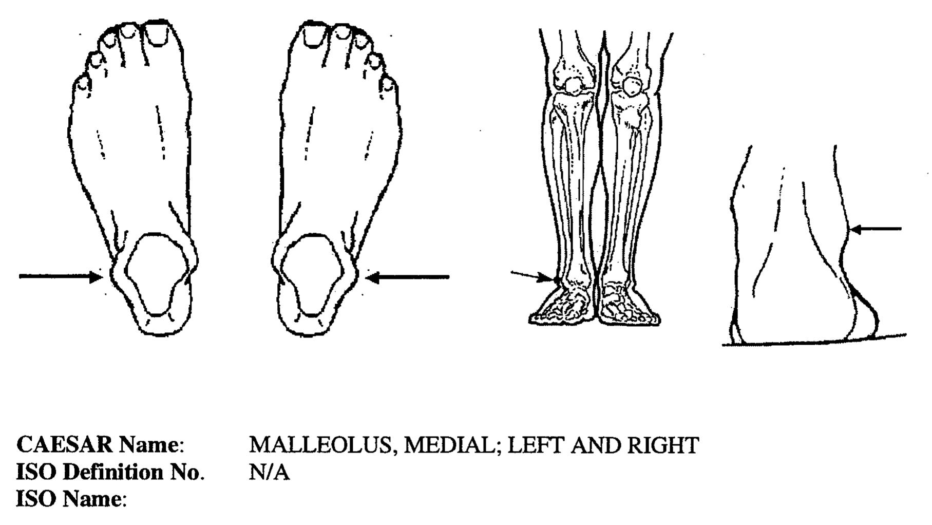 Description: medial point on the distal tibial protrusion of