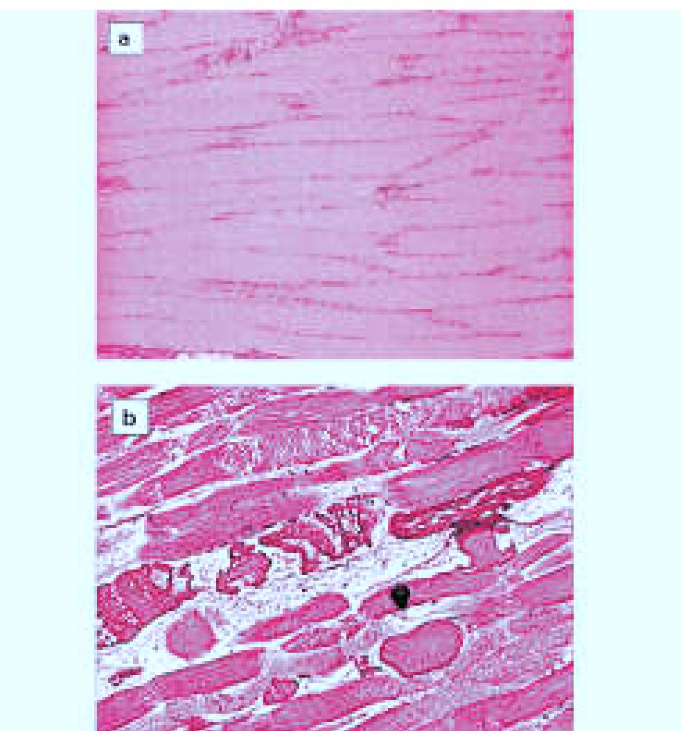 Longitudinal histology sections of skeletal muscle tissue