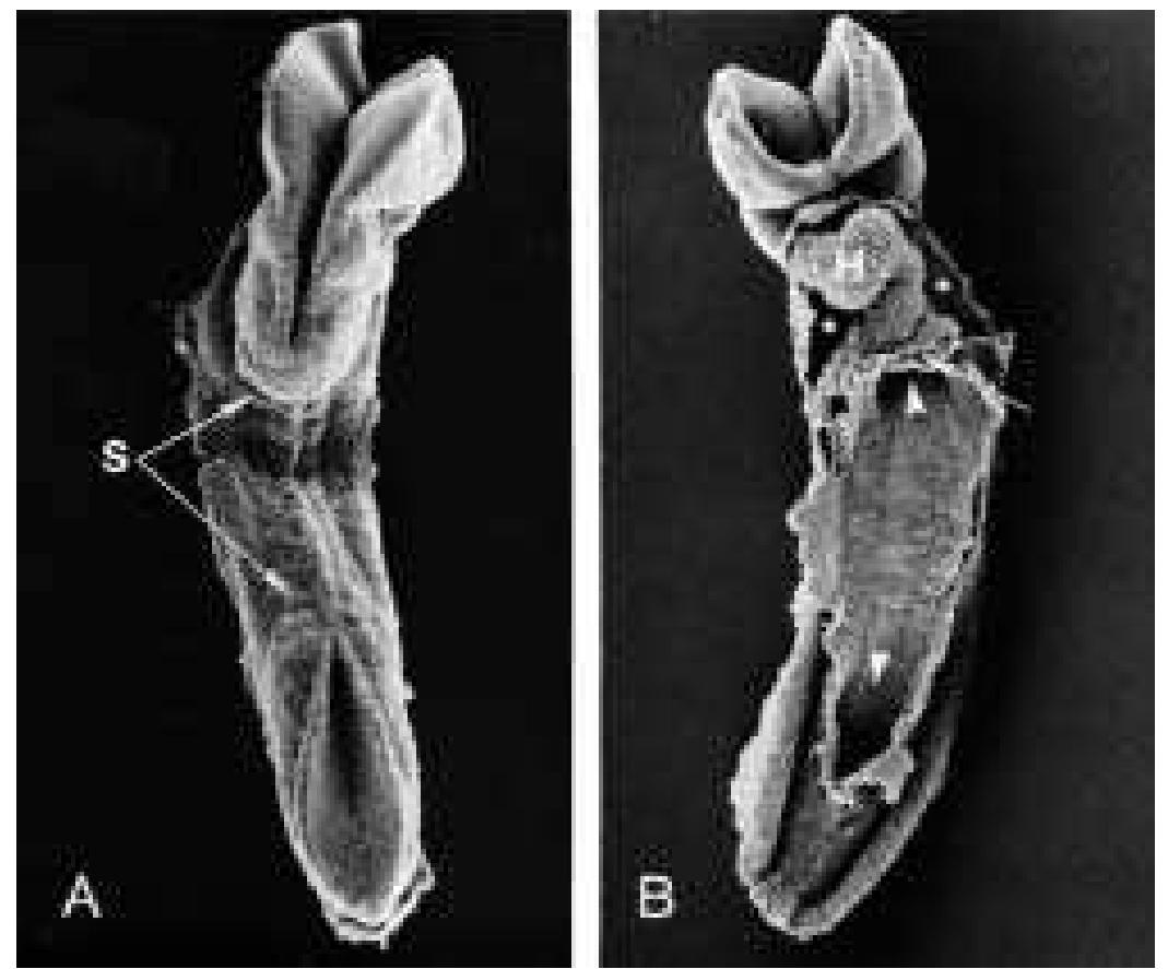 6 dorsal (a) and ventral (b) views of a mouse embryo