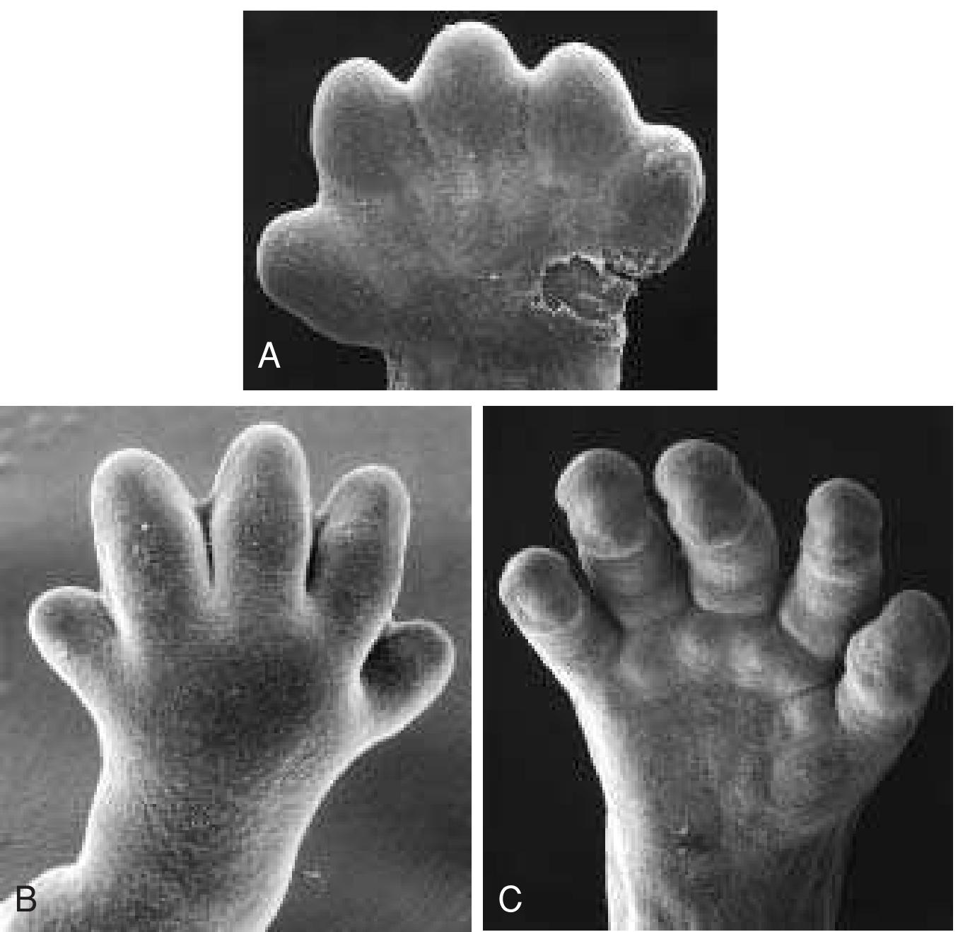 14 scanning electron micrographs of human hands. a. at 48