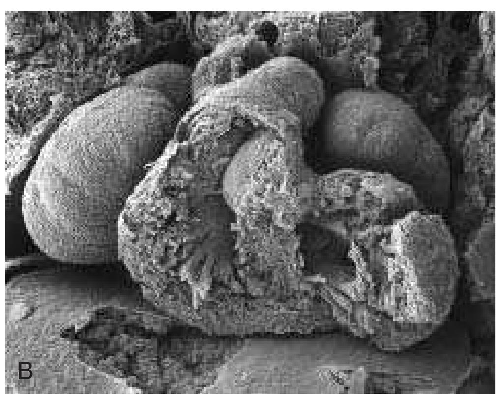 17 a. frontal section through the heart of a day 35 embryo.