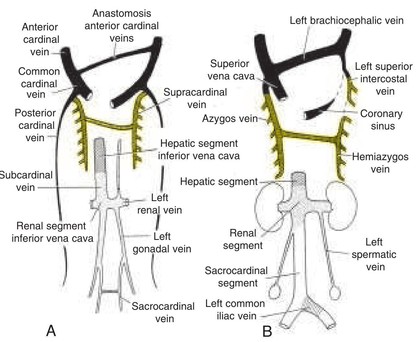 44 development of the inferior vena cava, azygos vein, and
