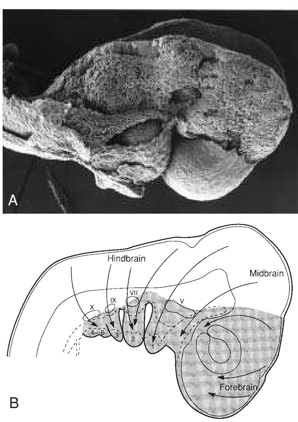 2 a. scanning electron micrograph showing cranial neural
