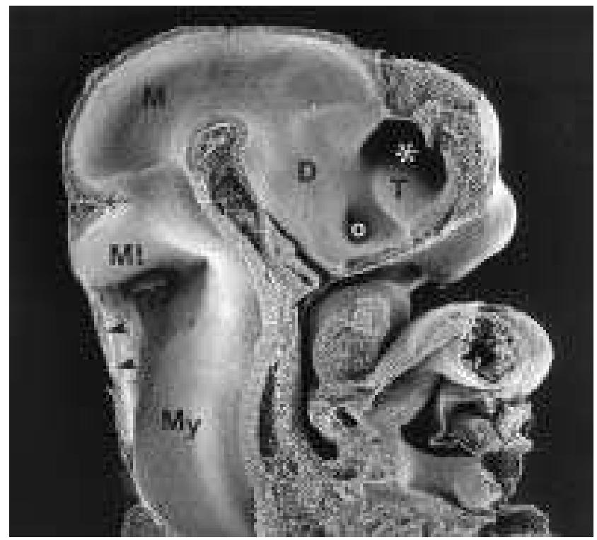 5 scanning electron micrograph of a sagittal section through