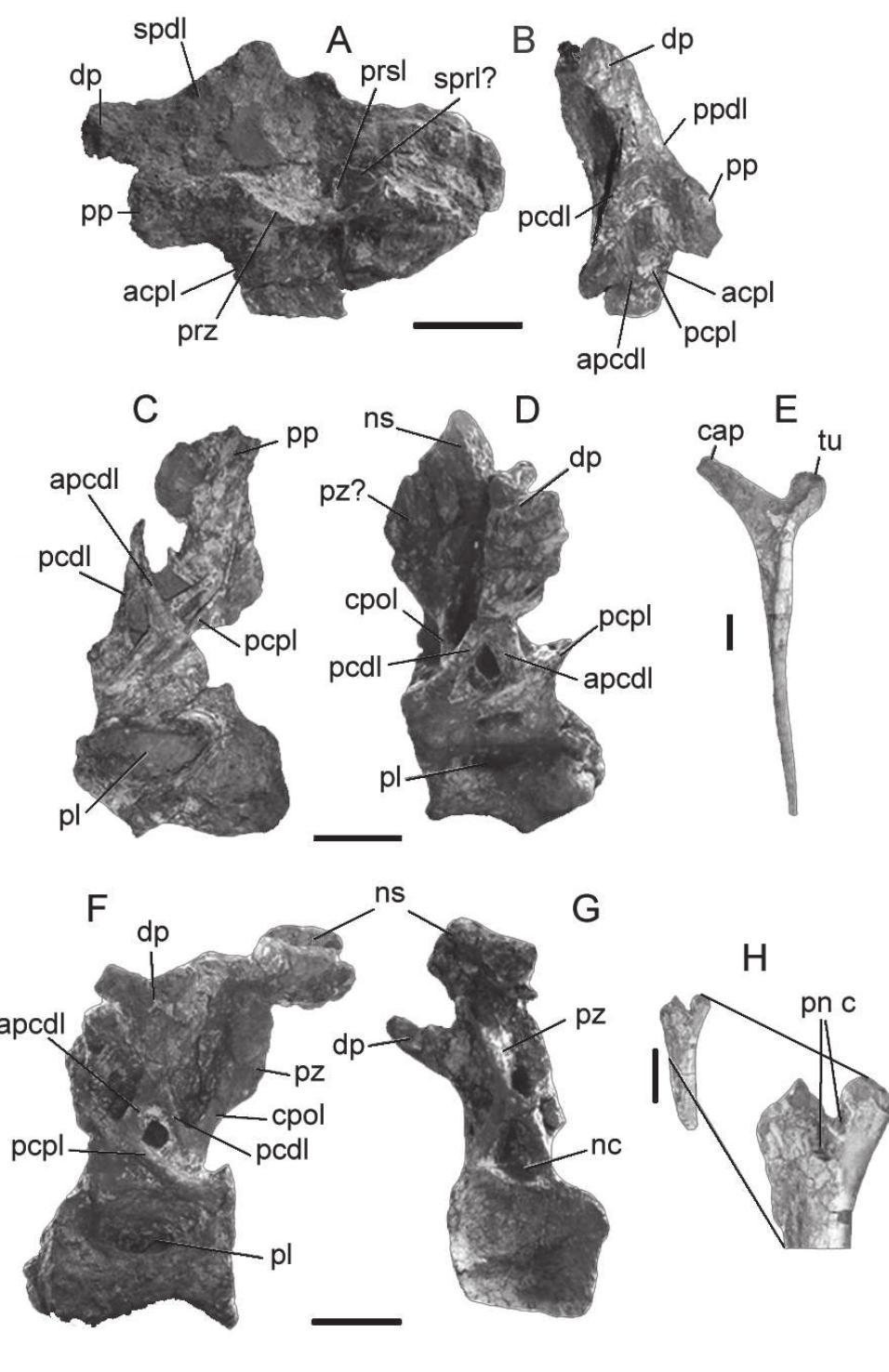 | posterior dorsal arch in a) anterior view and b) right