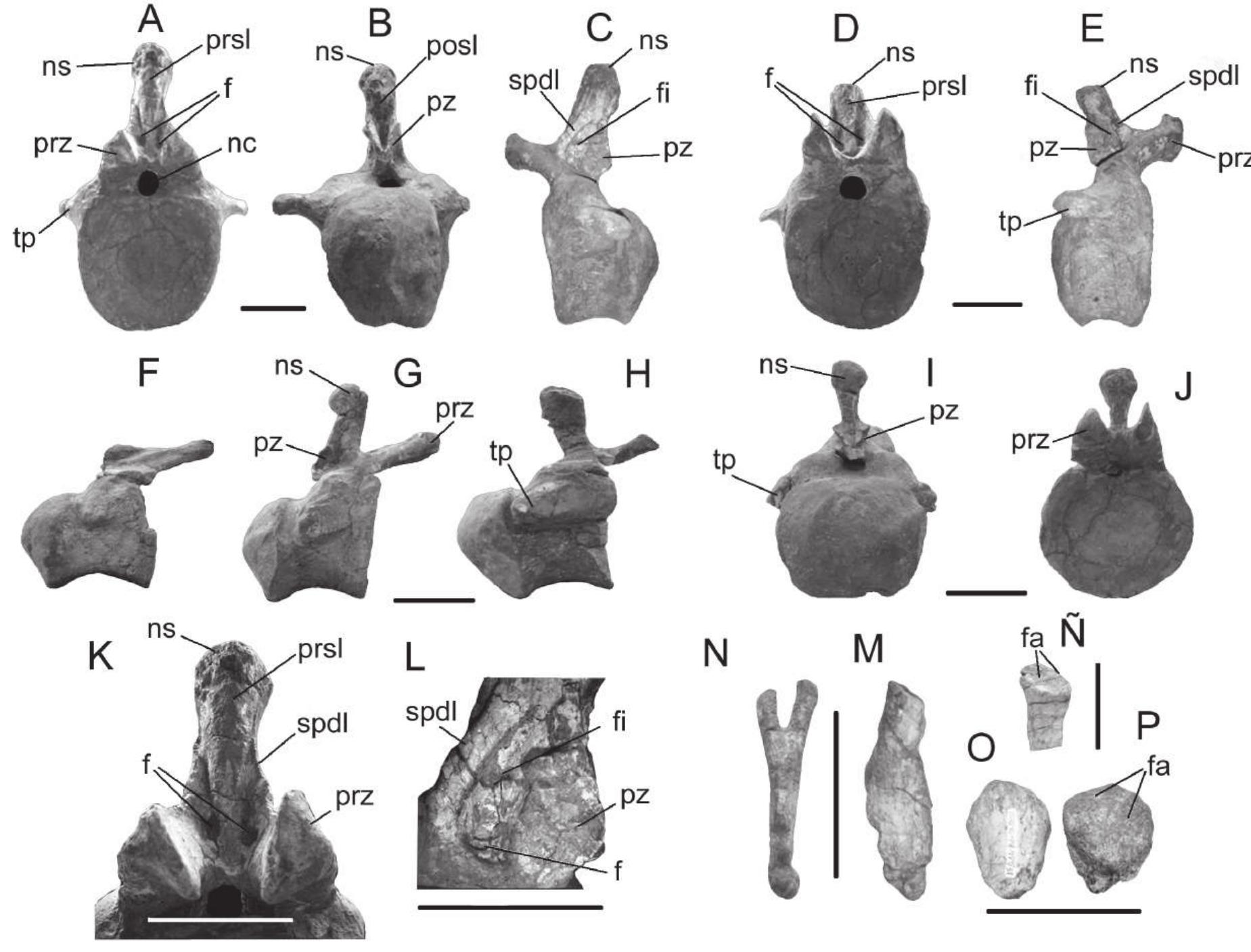 | caudal anterior vertebrae in a) anterior view, b)