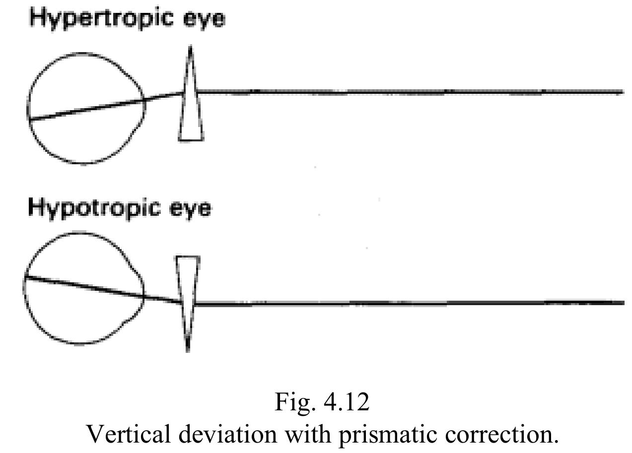 (PDF) Clinical Optics Elkington