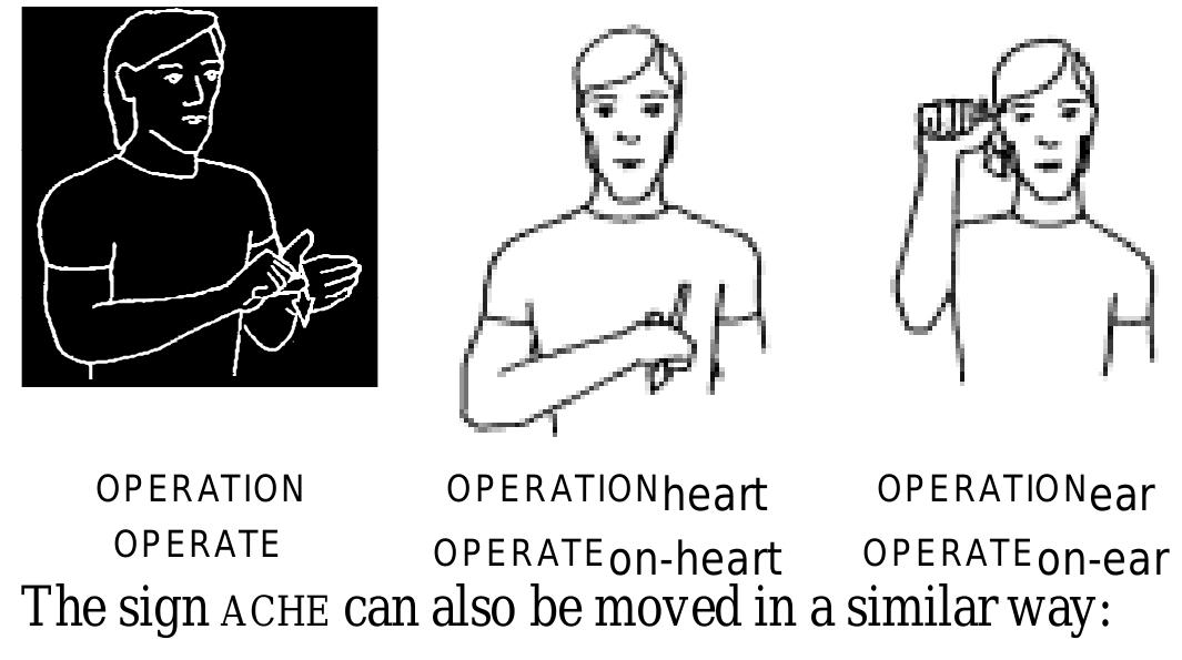 Figure 197 - (1989) Auslan: The Sign Language of the