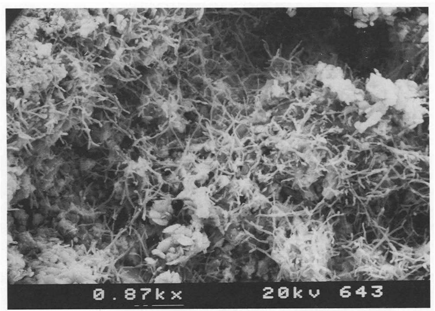 Electron micrograph showing biological activity. the longer
