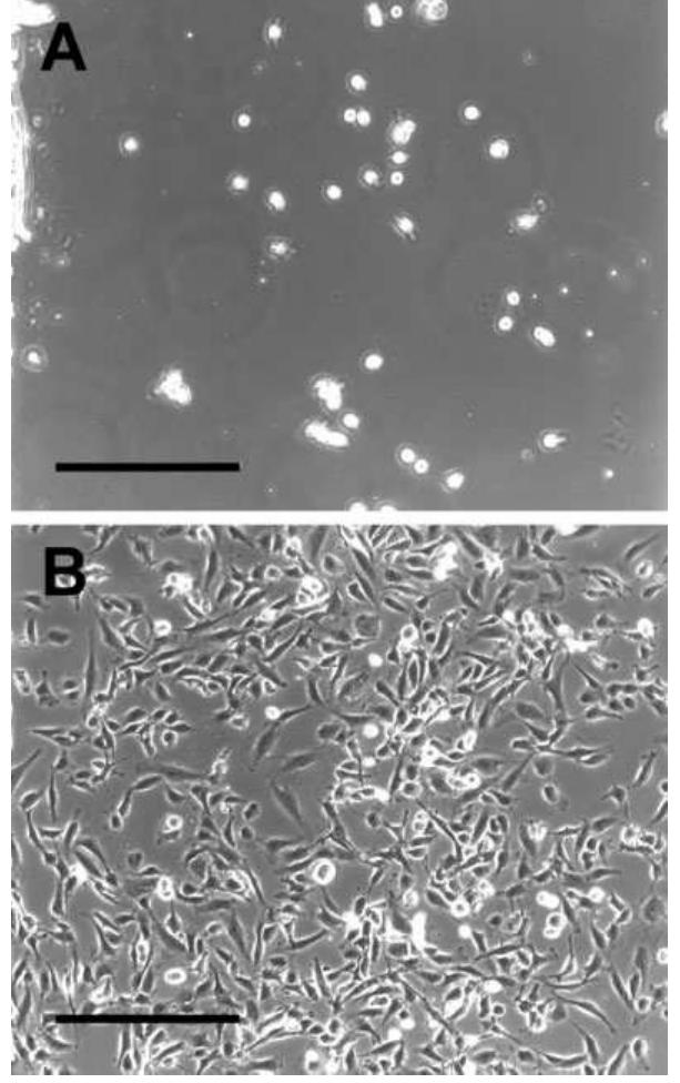 Light microscopy images of endothelial cells attached (3 h