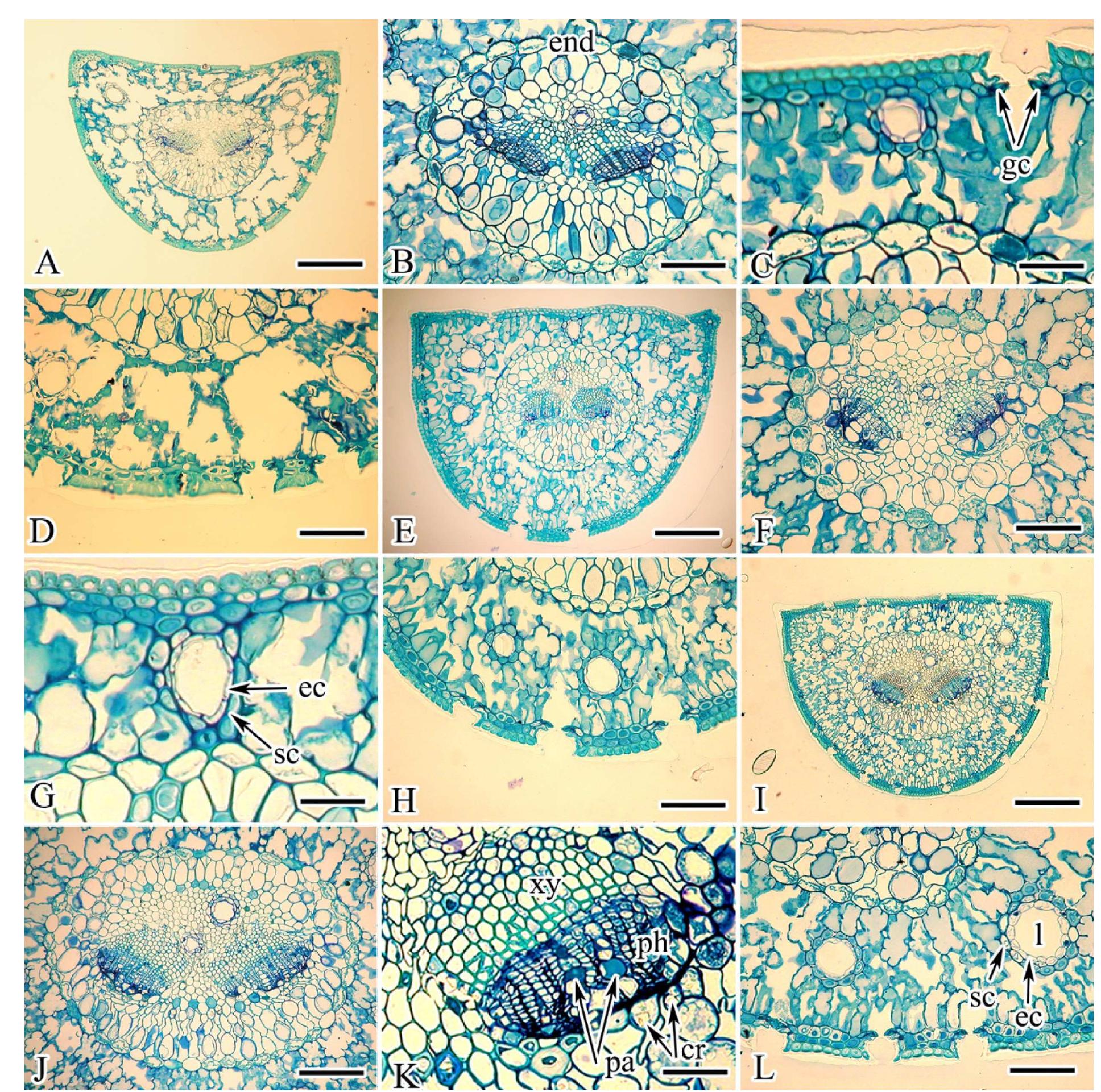 Cross section (cs) of pinus thunbergii leaf. a-d. samples of