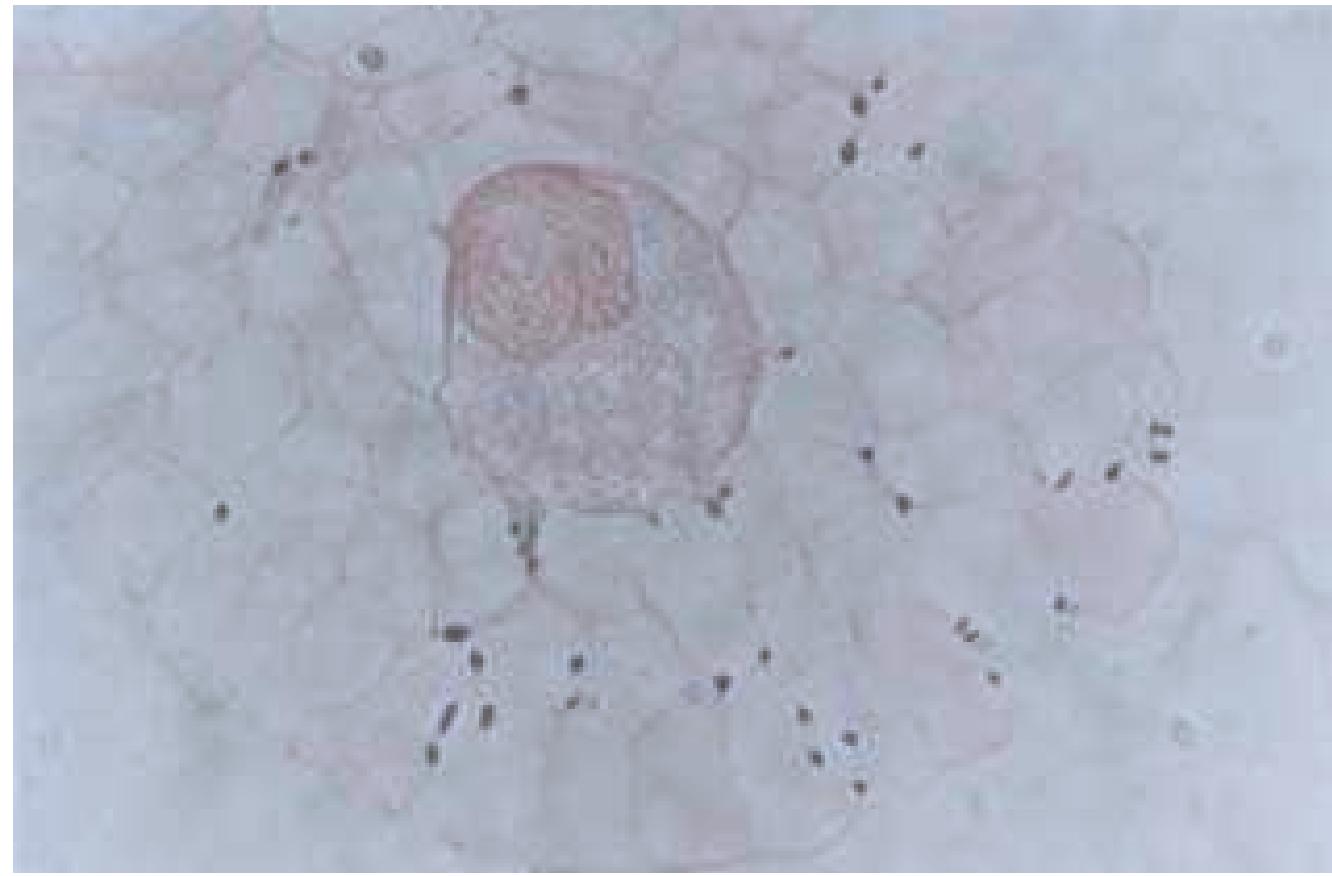Figure 3 - from Streptococcus suis