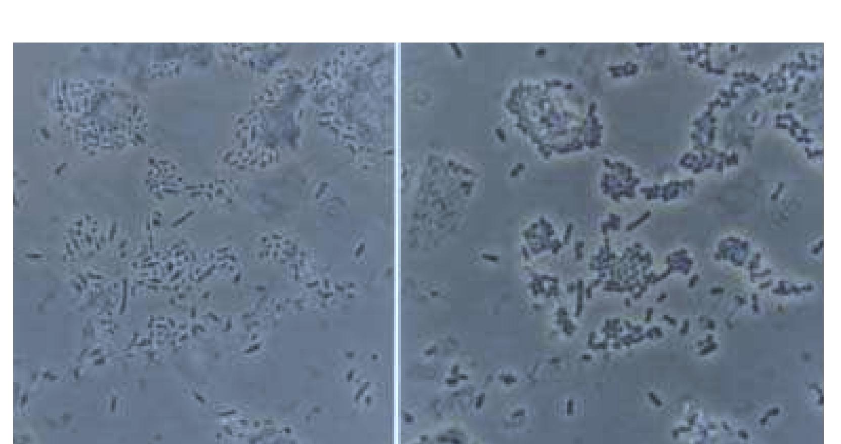 Streptococcus suis remains fully sensitive to the penicillin