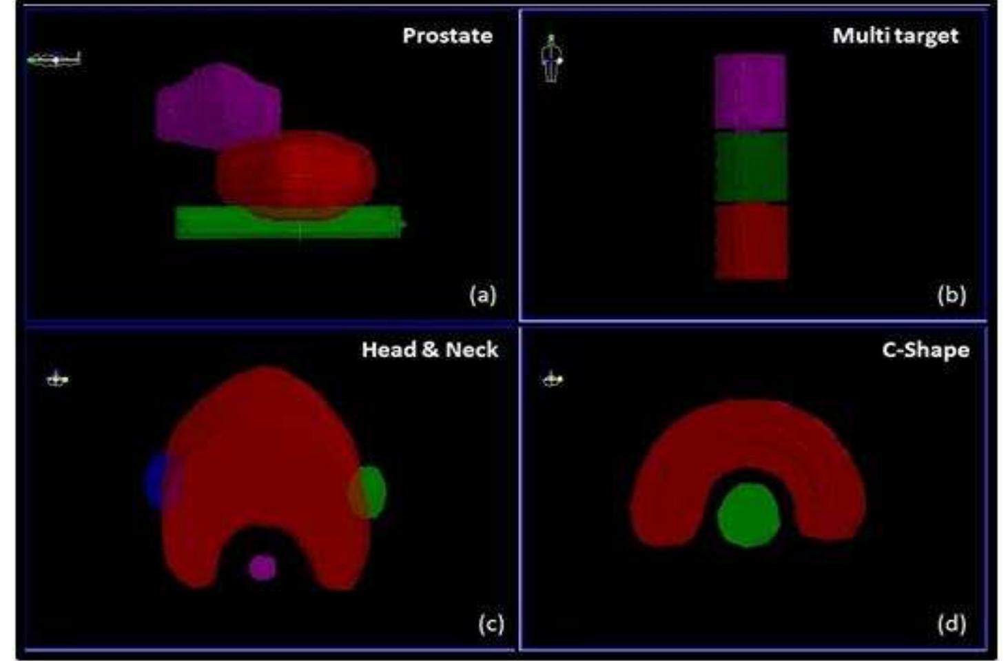 Figure 1 - IMRT AND VMAT COMMISSIONING FOR VERSA HD LINEAR