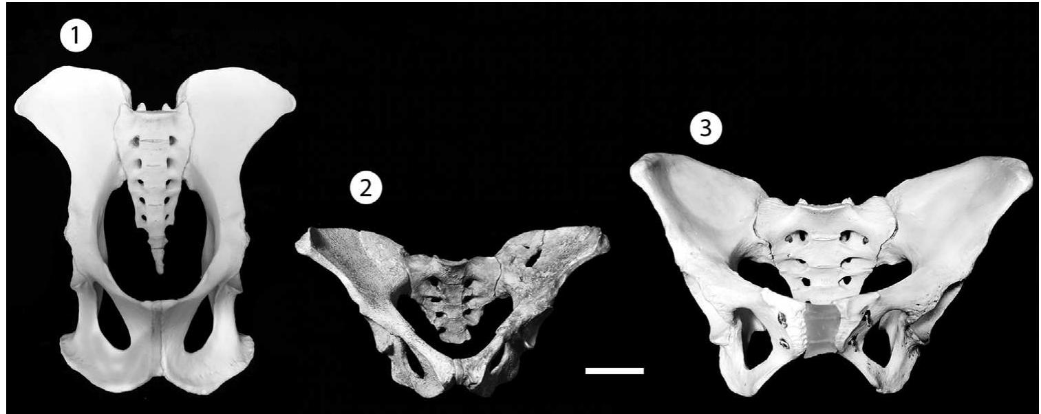 3. pelvis comparisons. shown are the complete pelvic girdles