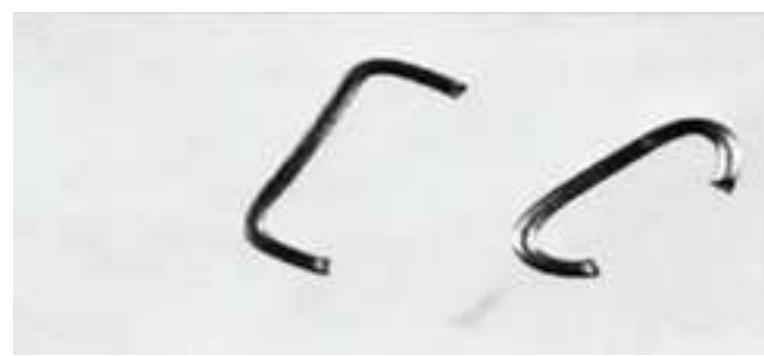 Medical staple before and after distraction (laster, macbean