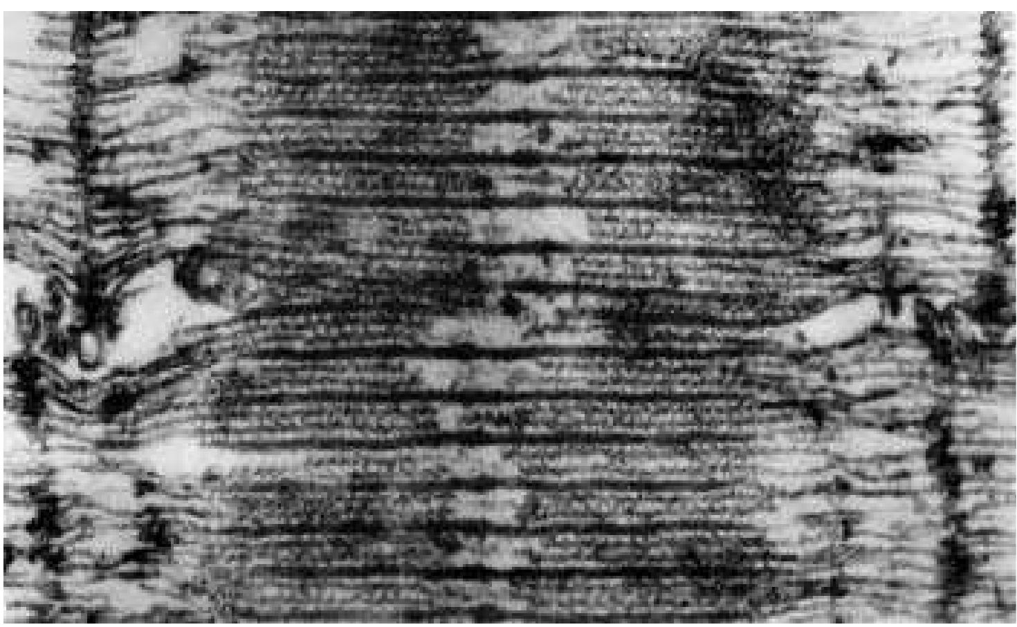 Figure 3 - Hugh E. Huxley: birth of the filament sliding