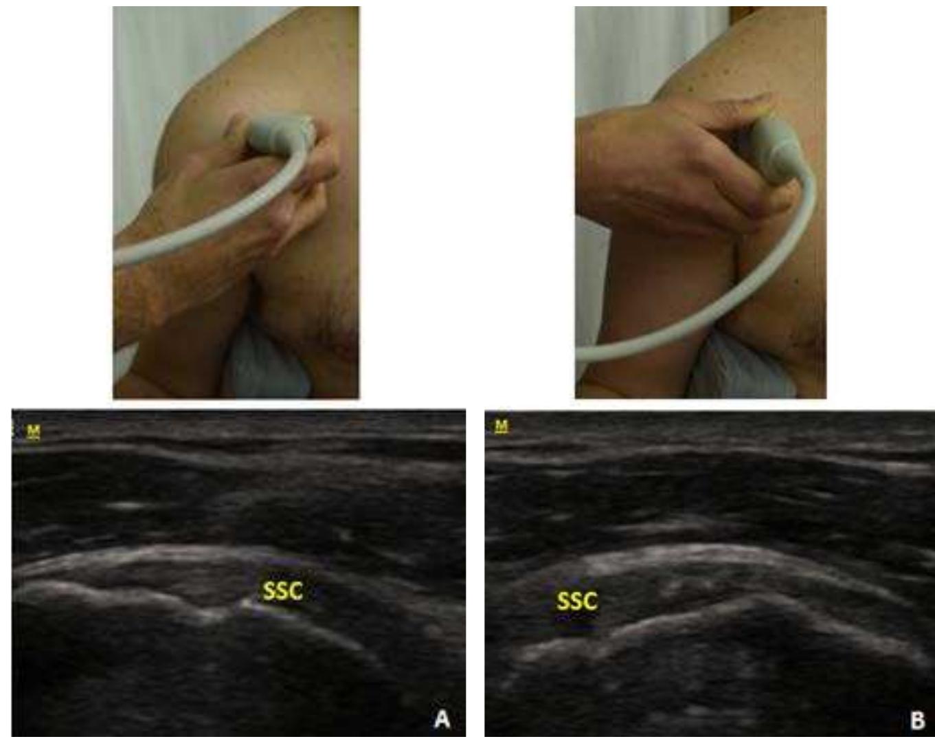 Longitudinal section ultrasound imaging measurement of
