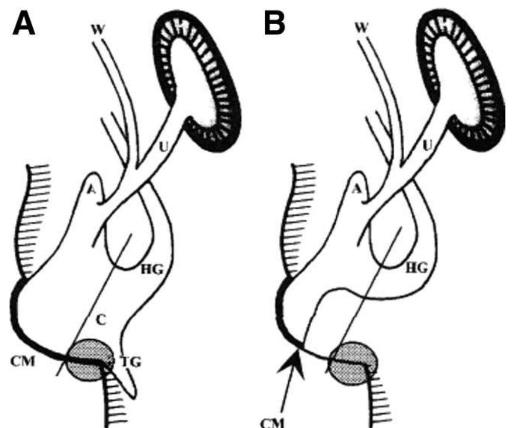 Schematic drawings of a normal (a) and an abnormal (b)