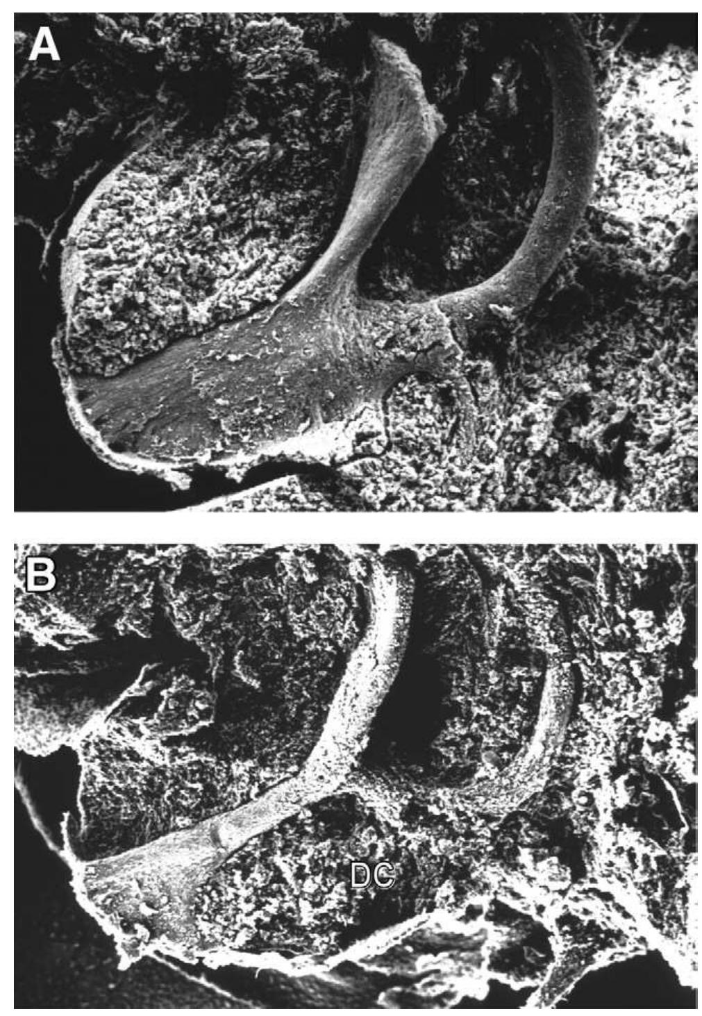 Sem photograph of a normal (a) and an abnormal (b)