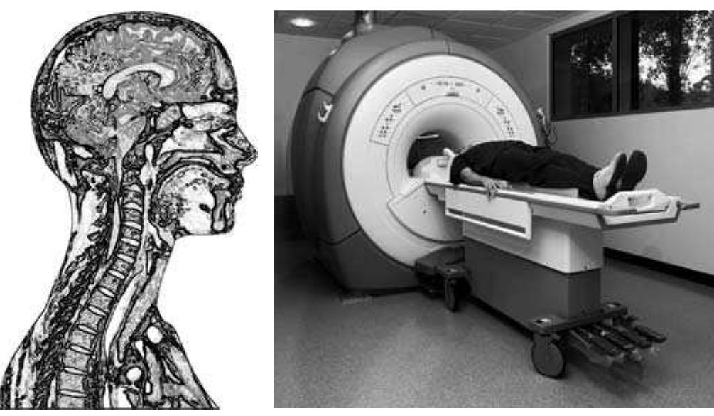 34. an mri scan of the head and shoulders, taken with an mri