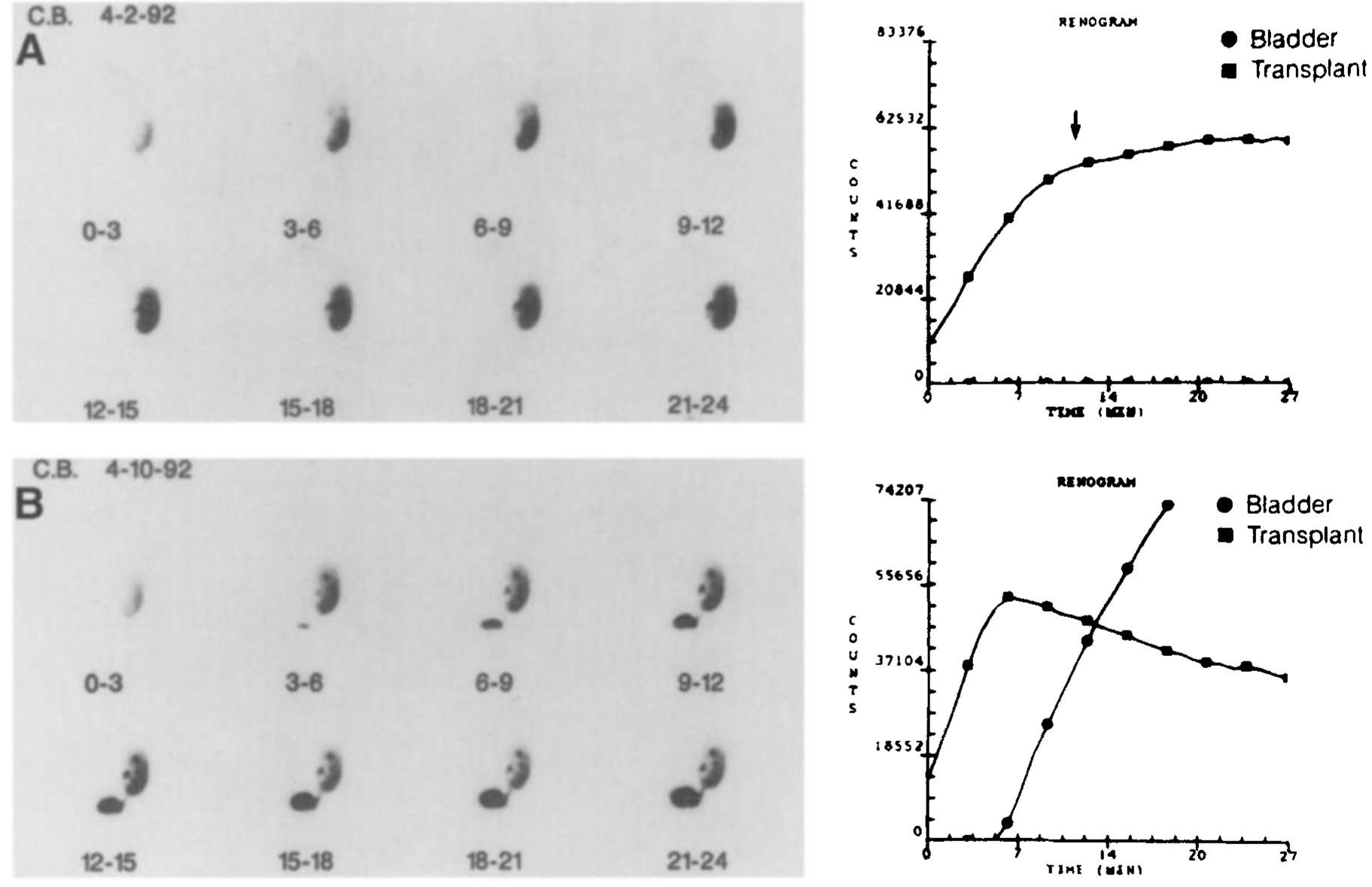 Scintigrams and time-activity curves of a 57-year-old man,