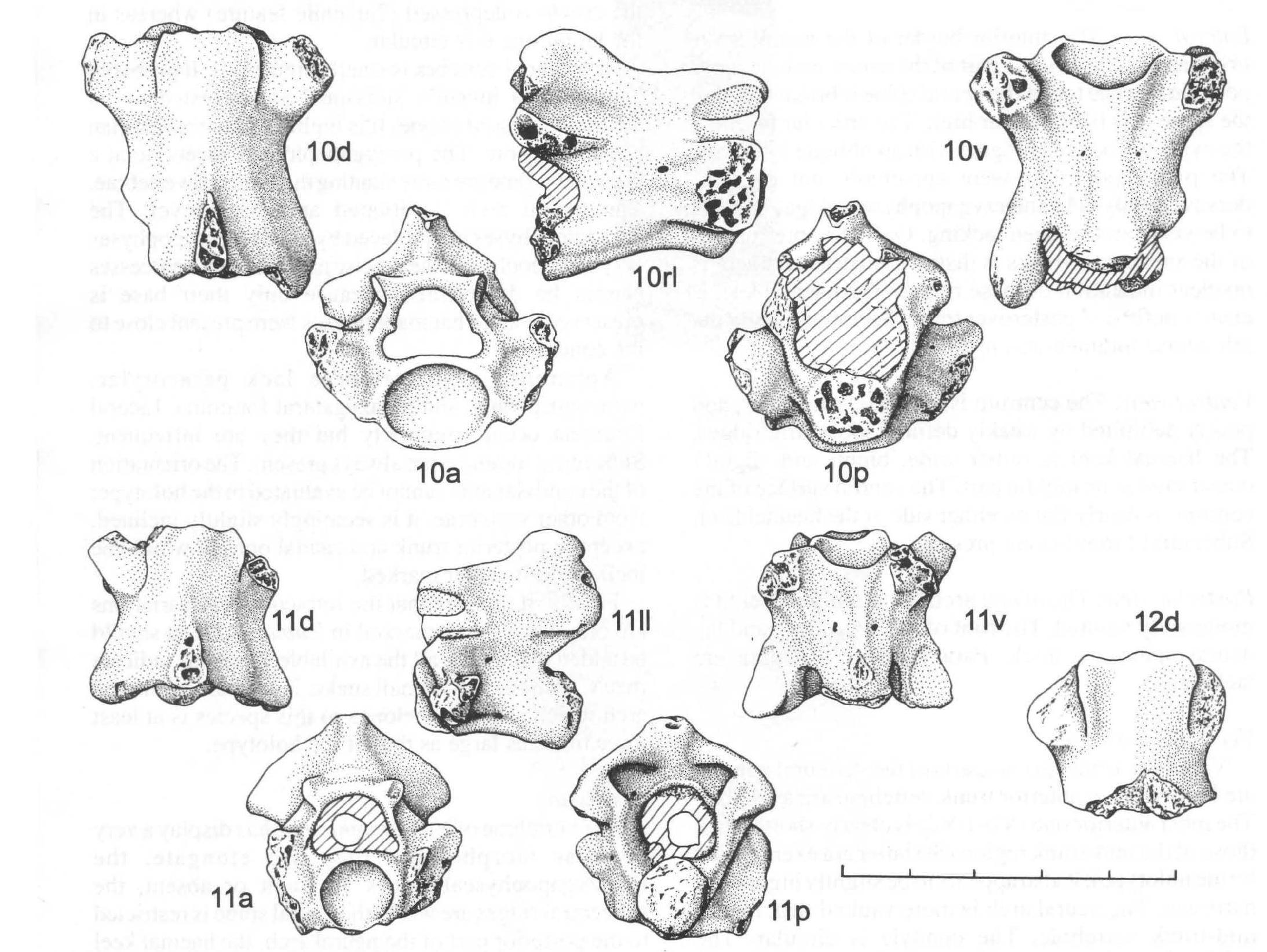 Anterior view. the vertebra appears moderately high and