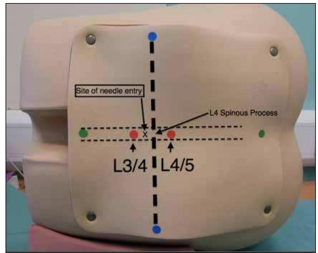 Surface markings for lumbar puncture from training mannequin