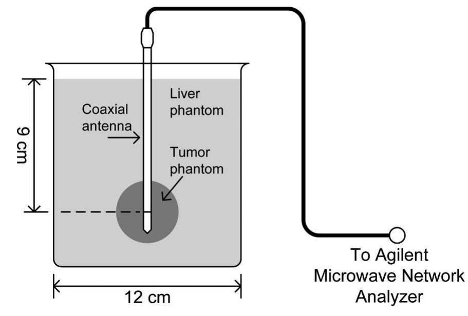 Phantom experiment system for tumor size estimation.