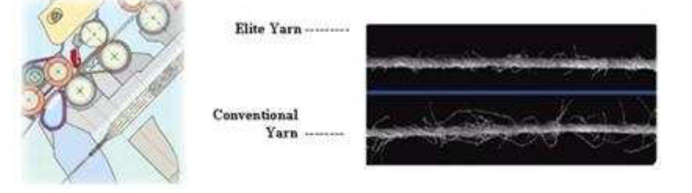 In the elite system of suessen, the condensing zone