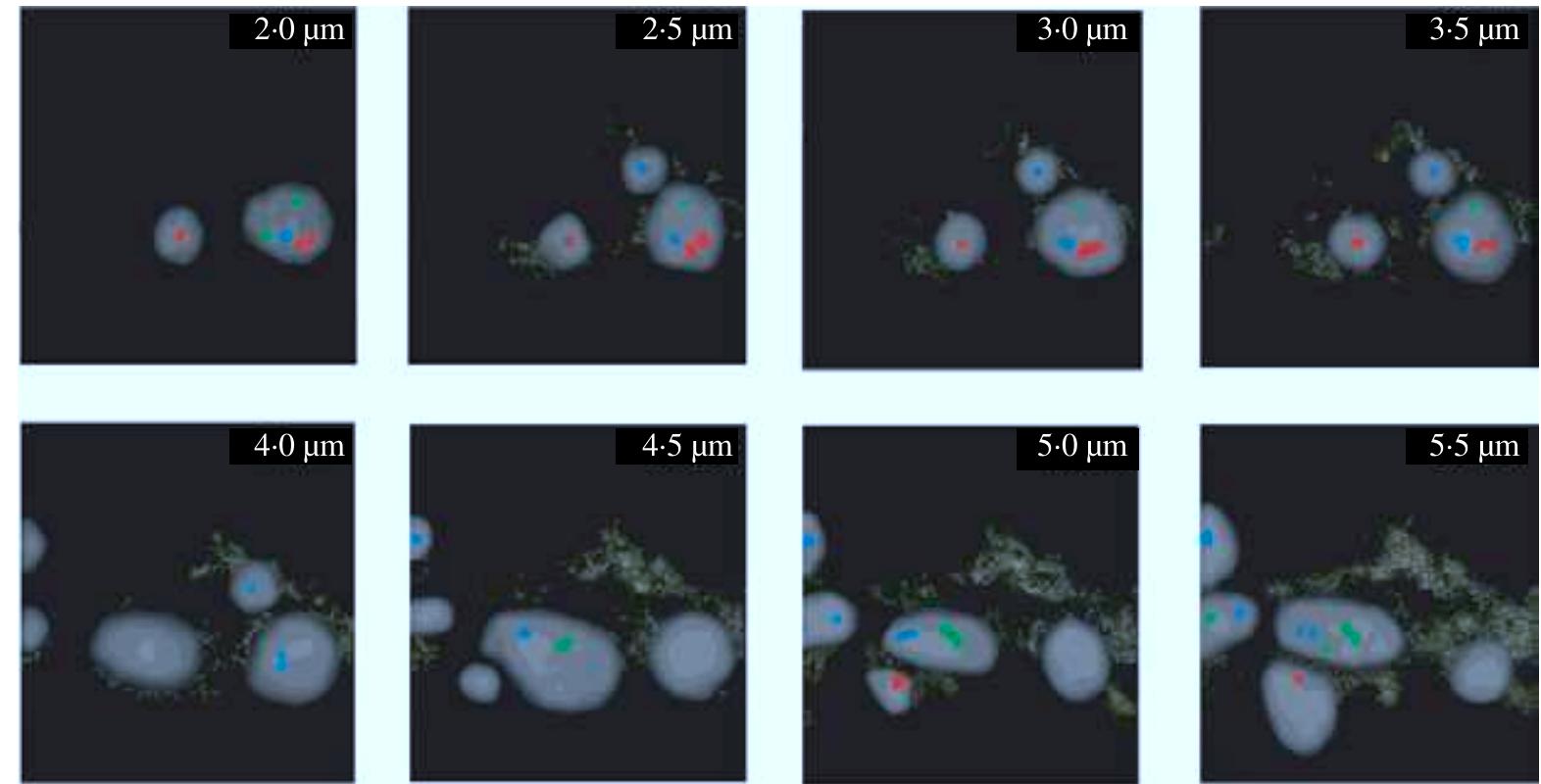 Imaging of centromeric fluorescent probes in human biopsies